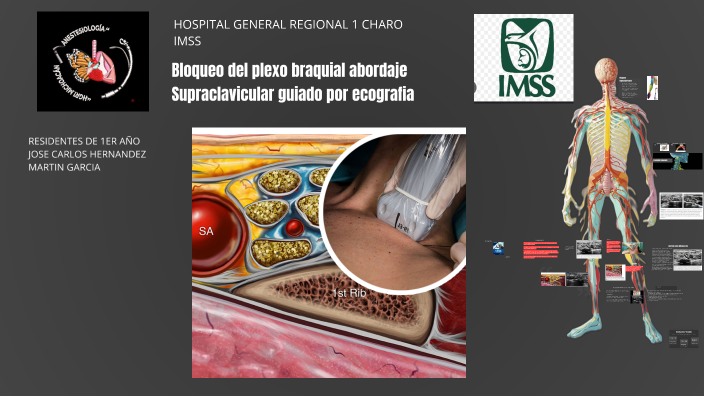Bloqueo Supraclavicular en Anestesiología by Maribel Valverde on Prezi