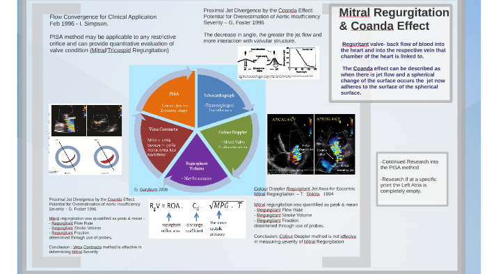 Mitral Regurgitation & Coanda Effect 1 by KS Baliram on Prezi