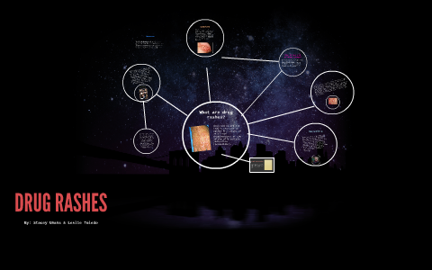 DRUG RASHES by on Prezi