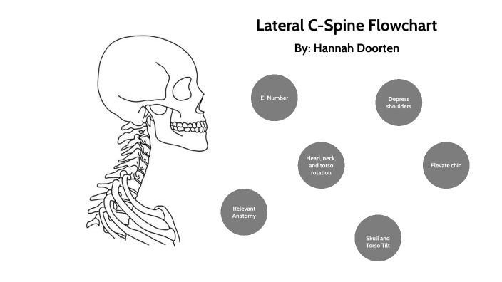 Lateral C-Spine Flowchart by Hannah Doorten on Prezi