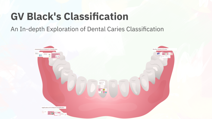 GV Black's Classification by Sana Ahmed on Prezi