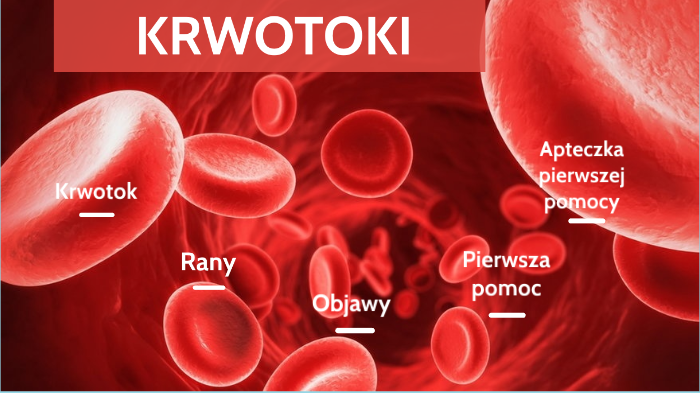 Krwotoki by prezentacje prezi on Prezi