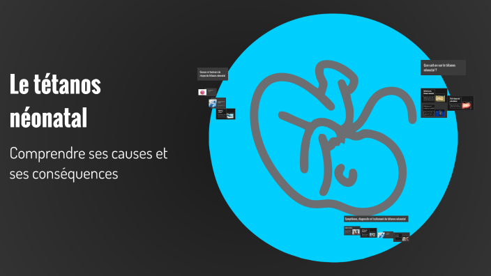 Le tétanos néonatal by Houda Elolich on Prezi
