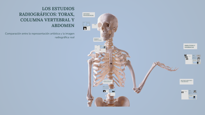 LOS ESTUDIOS RADIOGRÁFICOS: TORAX, COLUMNA VERTEBRAL Y ABDOMEN by Luisa ...