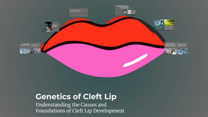 Genetics of Cleft Lip by maria Ilse salcedo gonzalez on Prezi