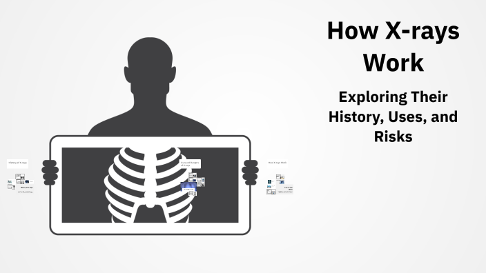 How X-rays Work by HighlyAware on Prezi