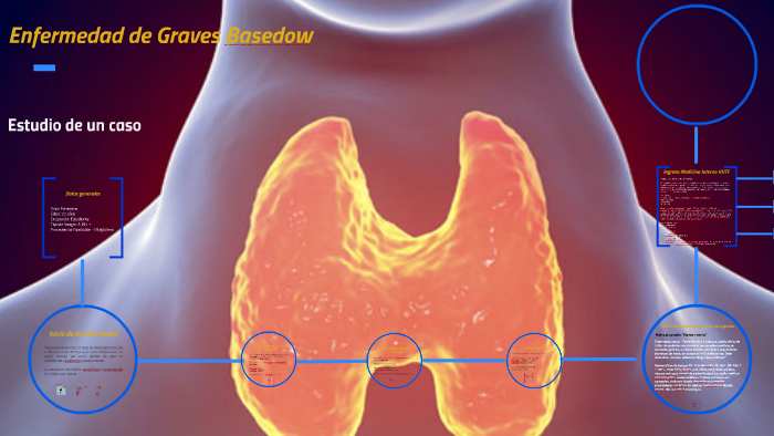 Enfermedad de Graves Basedow - Tirotoxicosis asociada a uso by Viviana ...