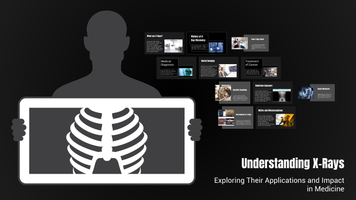 x rays by Jackson Barnes on Prezi