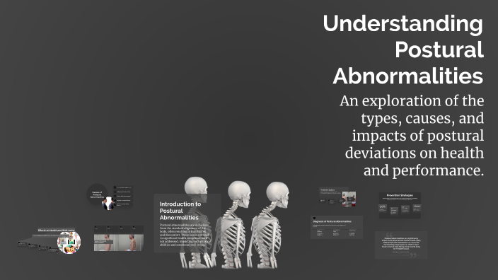 Understanding Postural Abnormalities by mohamed diwan on Prezi