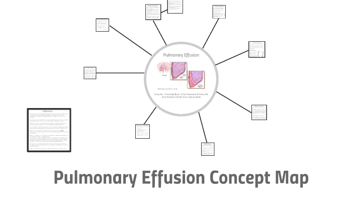 Pulmonary Effusion Concept Map by Sydney Webb on Prezi