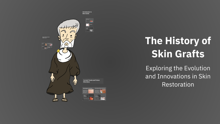 The History of Skin Grafts by brina hurry on Prezi