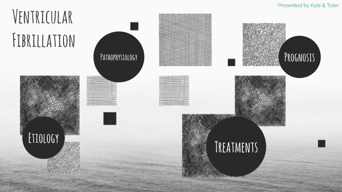 Ventricular Fibrillation by Tyler Verrill on Prezi