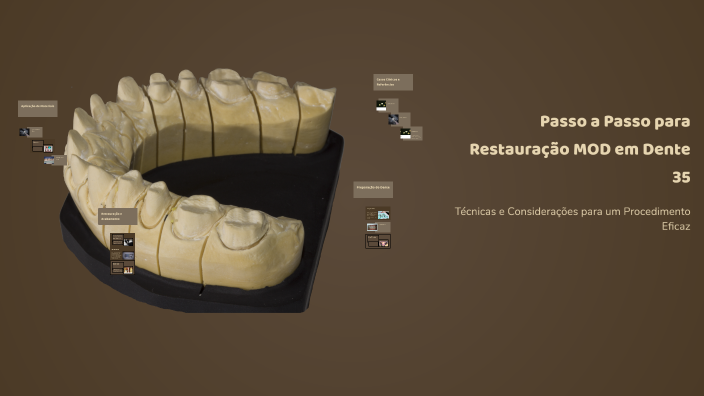 Passo a Passo para Restauração MOD em Dente 35 by Nathaly Cavalcante on ...