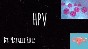 HPV Powerpoint by Natalie Ruiz on Prezi Design
