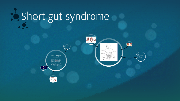 Short gut syndrome by missael student on Prezi