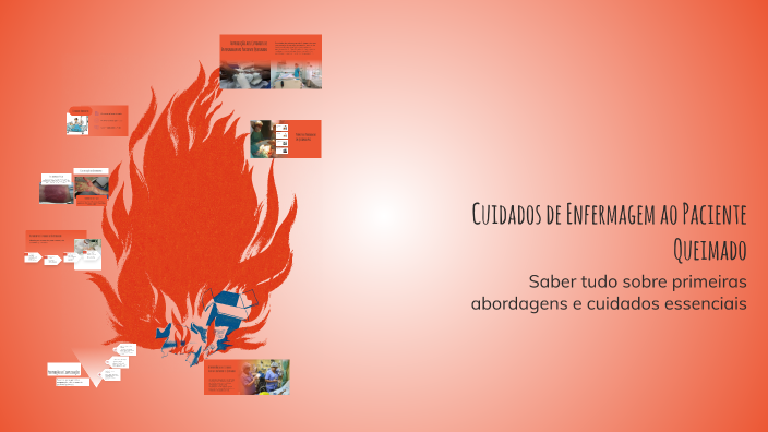 Cuidados de Enfermagem ao Paciente Queimado by Mayara Carvalho on Prezi