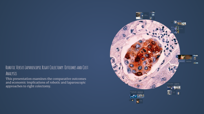 Robotic Versus Laparoscopic Right Colectomy: Outcomes and Cost Analysis ...
