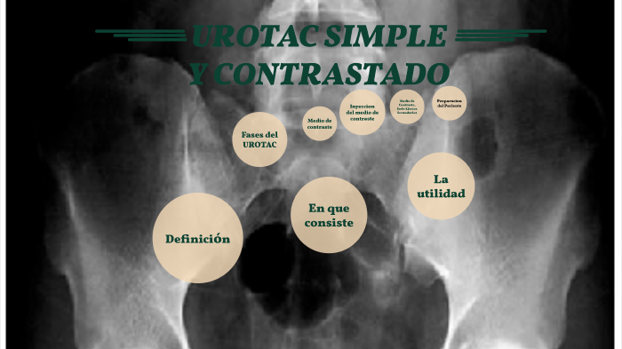 UROTAC SIMPLE Y CONTRASTADO by SAMANTHA MALEZA on Prezi