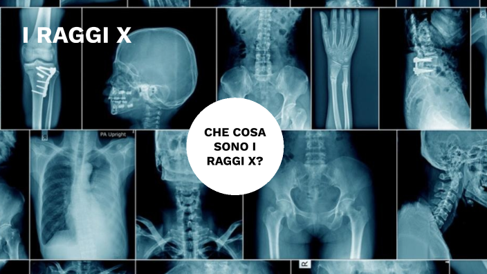 RAGGI X by camelia postica on Prezi