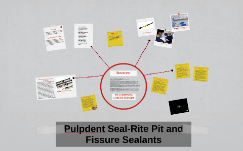 Pulpdent Seal-Rite Pit and Fissure Sealants by courtney labossiere on Prezi