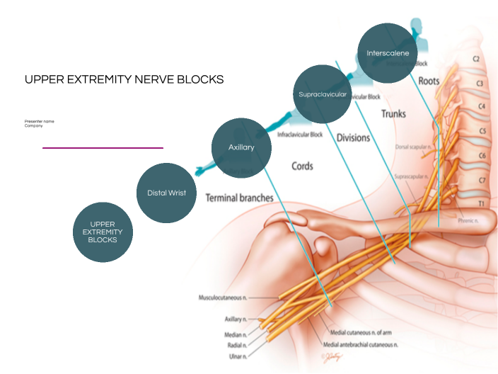 Regional Anesthesia Workshop 2 by Sab on Prezi
