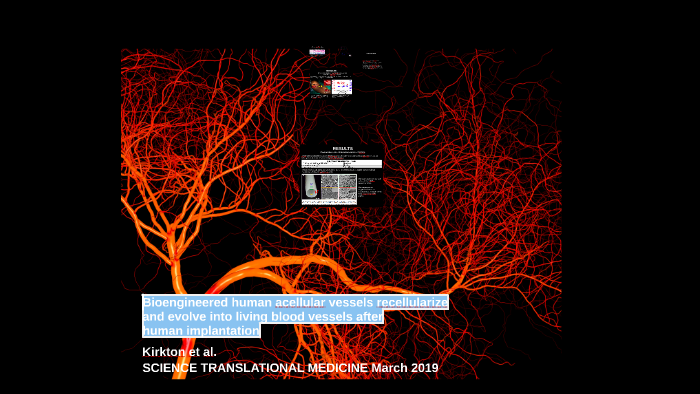Bioengineered human acellular vessels recellularize by Harish ...