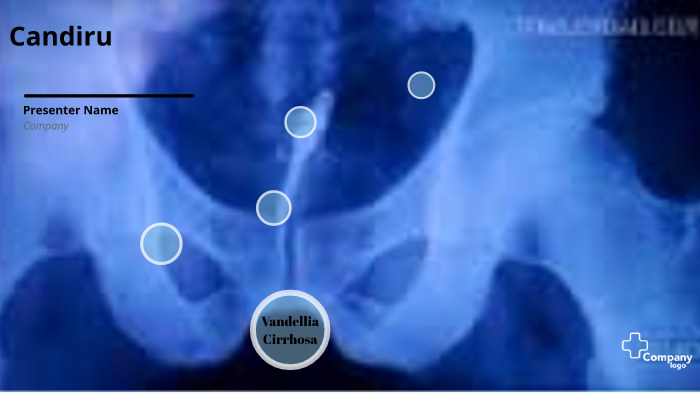 candiru by Vanessa Rubio on Prezi