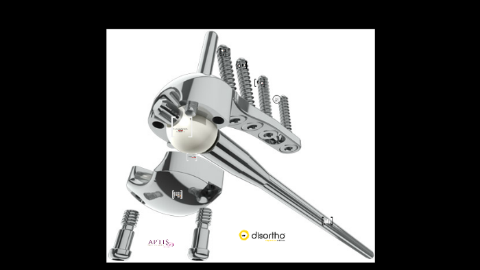 Prótesis radio-cubital distal de SCHEKER by waded bernal on Prezi