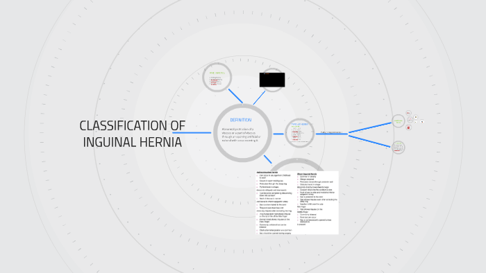 CLASSIFICATION OF INGUINAL HERNIA by Altaf Pathan on Prezi