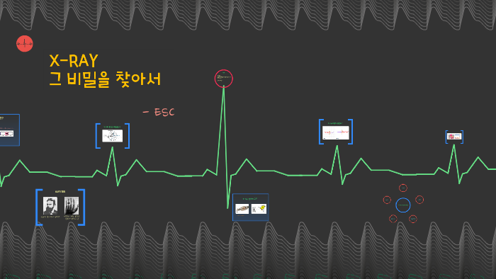 X-ray by 세현 윤 on Prezi