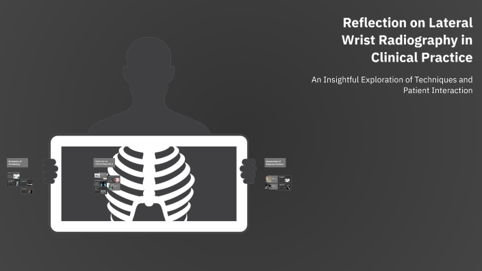 Reflection on Lateral Wrist Radiography in Clinical Practice by irencheto arn on Prezi