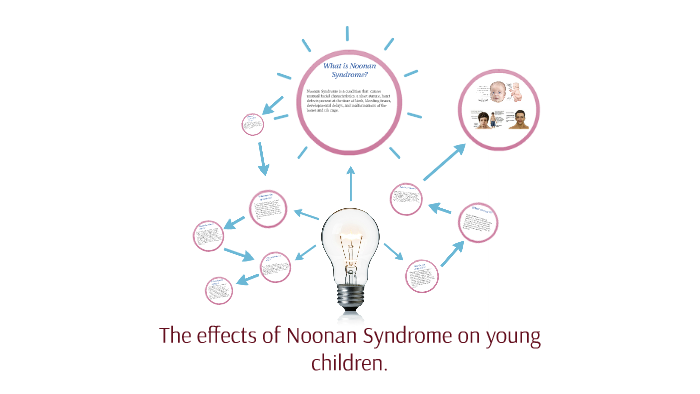 The effects of Noonan Syndrome on young children. by sarah wingrove on ...