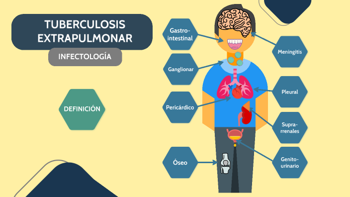 Tuberculosis extrapulmonar by Octavio Aguilar on Prezi