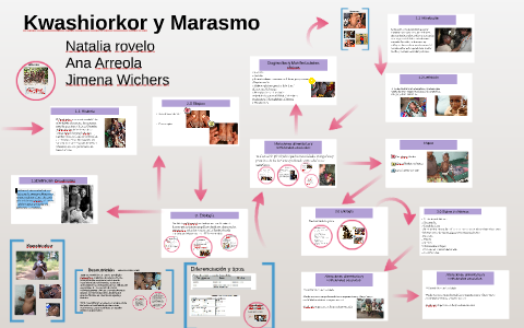 Kwashiorkor y Marasmo by natalia rovelo on Prezi