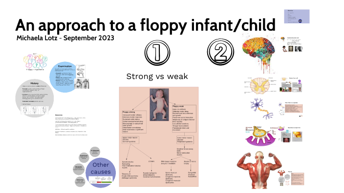 Approach to a floppy child by Michaela Lotz on Prezi