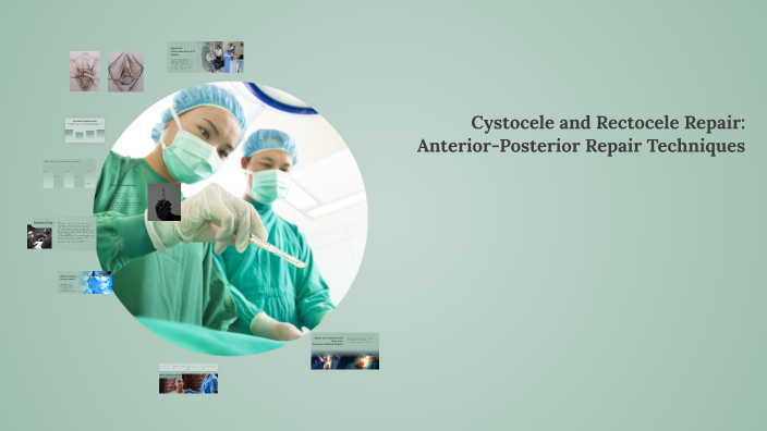 Understanding Cystocele and Rectocele Repair: Anterior-Posterior Repair ...