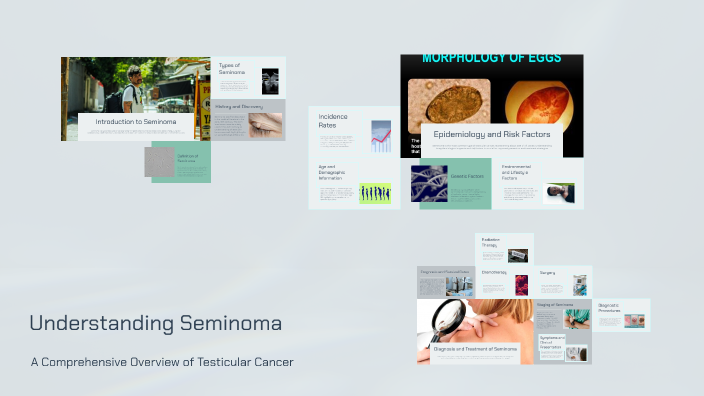 Understanding Seminoma by abdullah waheeb on Prezi