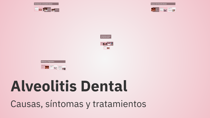 Alveolitis Dental by kayra Hernandez on Prezi
