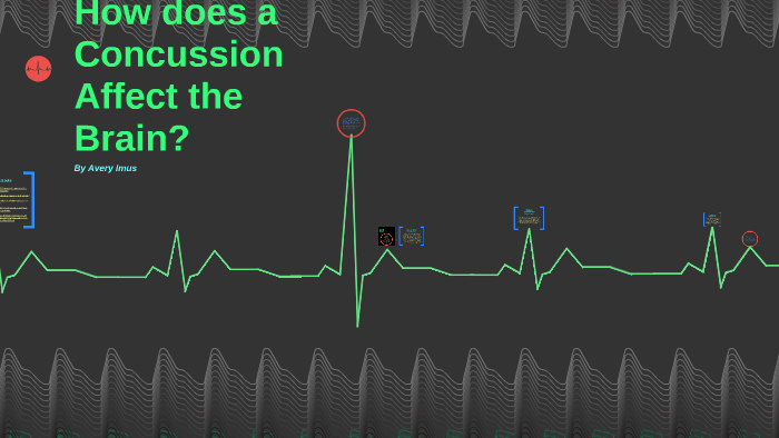 How does a Concussion Affect the Brain? by Avery Imus on Prezi
