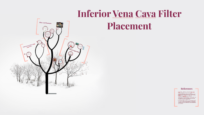 Inferior Vena Cava Filter Placement by Christian Resurreccion on Prezi