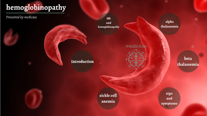 hemoglobinopathies by medicase basij on Prezi