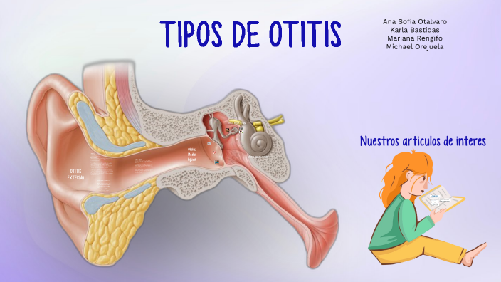 TIPOS DE OTITIS by ANA SOFIA OTALVARO GARCIA on Prezi