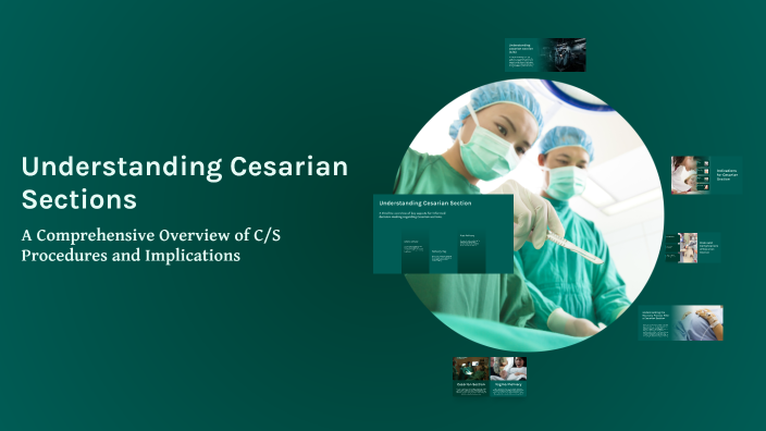 Understanding Cesarian Sections by Govar Ahmad on Prezi