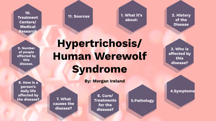 Disease Research Project by Morgan Ireland on Prezi