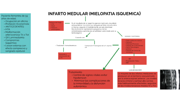 INFARTO MEDULAR by Jennifer Hobaica on Prezi