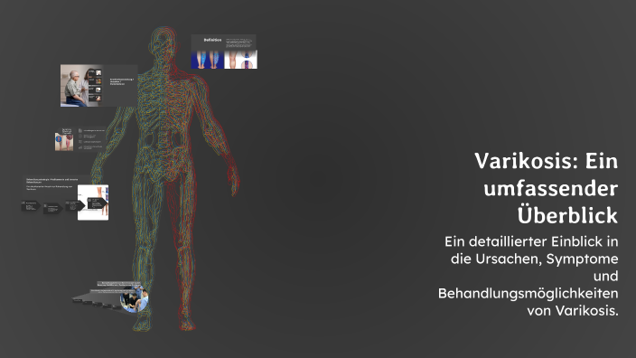 Varikosis: Ein umfassender Überblick by Klodjana Hyseni on Prezi