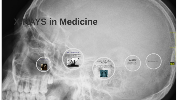 X-RAYS in Medicine by Cecilia Marquez on Prezi