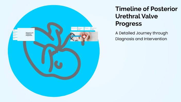 Timeline of Posterior Urethral Valve Progress by Rita K on Prezi