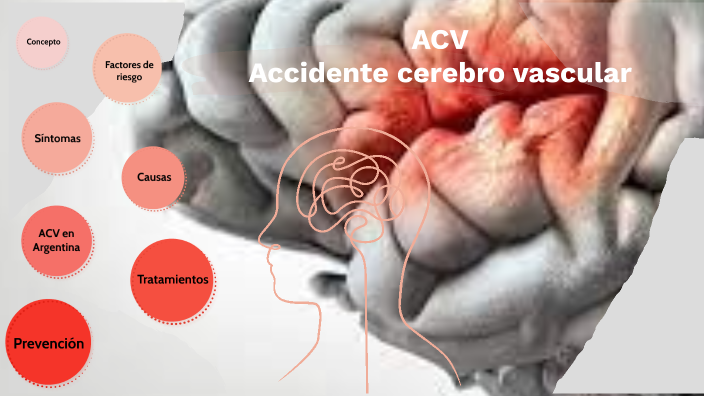 ACV by Sofia Sanchez on Prezi