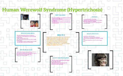 Human Werewolf Syndrome (Hypertrichosis) by Octavia Mack on Prezi